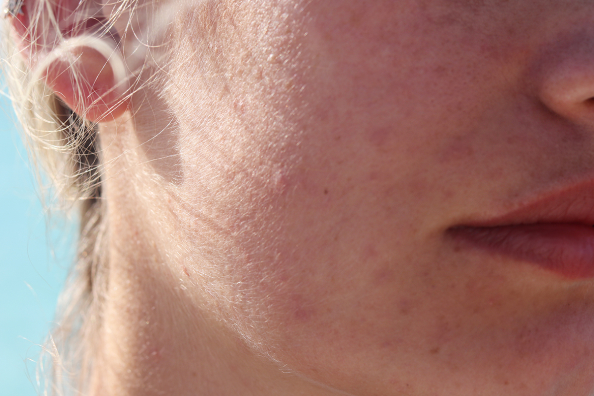 MS SOHO’S GOLDEN COLLAGEN CLEANSE MASKS – AND A THOUSAND WORDS